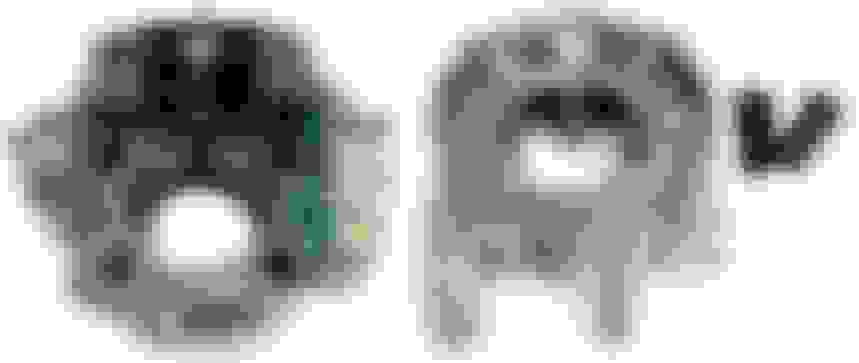 Where to find new Steering Column Knuckle (1990-1996)? - CorvetteForum ...