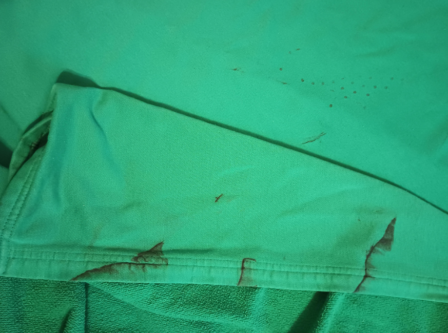 Help! Endless scrud! Kenmore front loading washer 417.40412703 ...